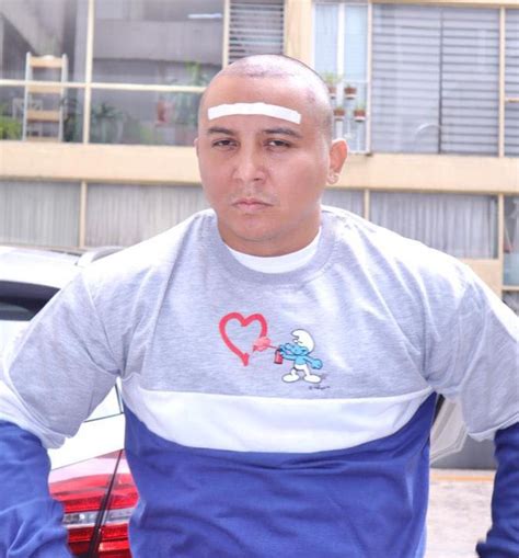 Edwin Luna Antes Despues 18 Barrio