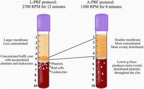 Science Behind PRF Bio PRF