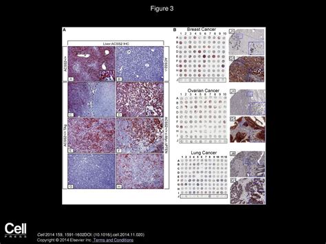 Acetate Dependence Of Tumors Ppt Download
