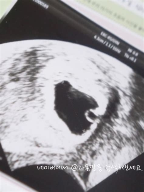 네이버 인플루언서