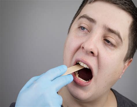 Faringitis Síntomas Y Tratamiento