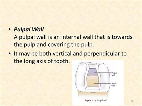 04principles Of Tooth Preparation Pptx