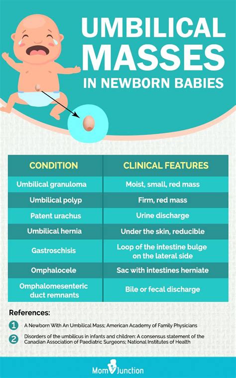 Umbilical Hernia Newborn