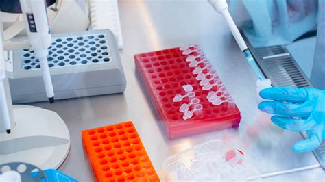 Comparing SCSA DFI Which DNA Fragmentation Test Is Best