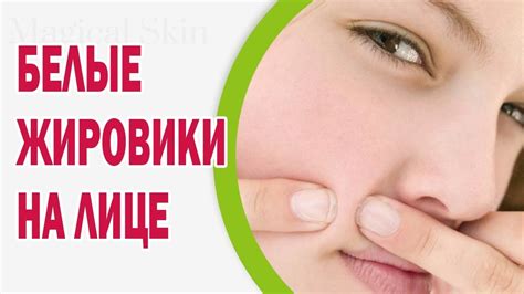 Жировик На Лице Картинки – Telegraph