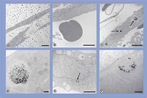 Transmission Electron Micrographs Of Osteogenic Cells Exposed To Either Download Scientific