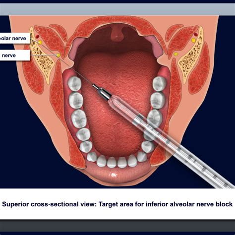 Medical Legal Exhibits Legal Animations And Trial Graphics Tria