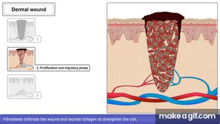 Skin Wound Healing Process On Make A 