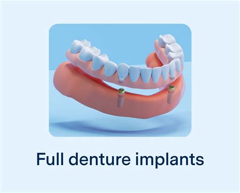 What Are Snap On Dentures With Implants And Are They Right For You