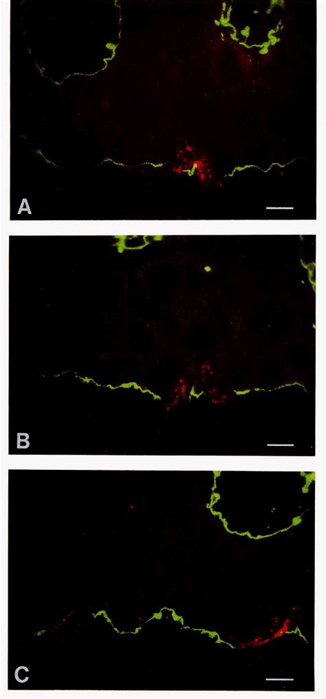 Electron Lucent Layer Of Basal Lamina Of Connective Tissue Semantic