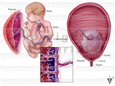 Stock Pregnancy Delivery Normal Placenta — Illustrated Verdict