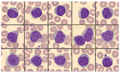 Inclusions Lablogatory