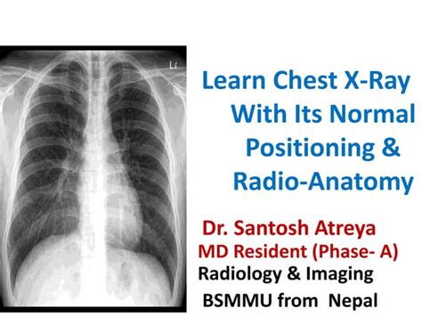 Chest Xray Lateral View Radiology Basics Pdf