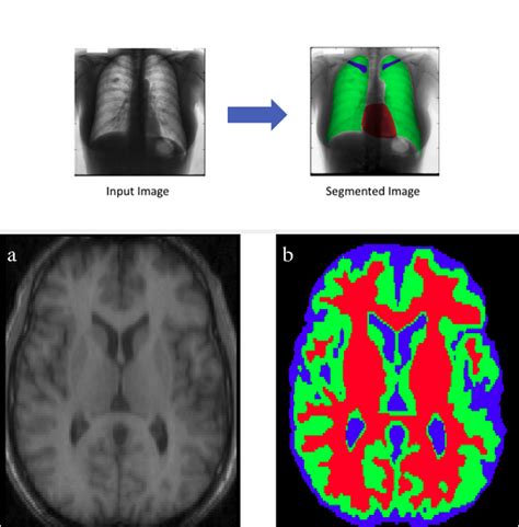 an overview of image segmentation part 2