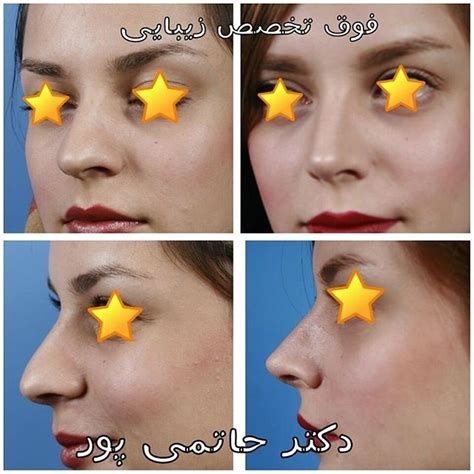 دکتر ابراهیم حاتمی پور هزینه، نوبت دهی نمونه کار کارشد