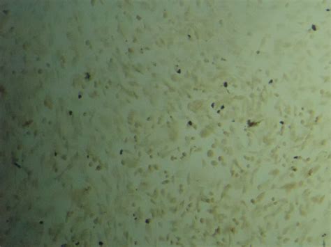 Does Anyone Have A Protocol For Icc Staining For Pax 7 In Human Muscle