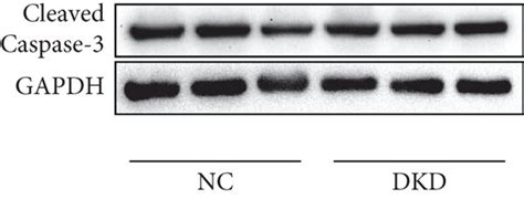 HG Induced Necroptosis In Kidney By Activation Of The RIPK1 RIPK3 MLKL