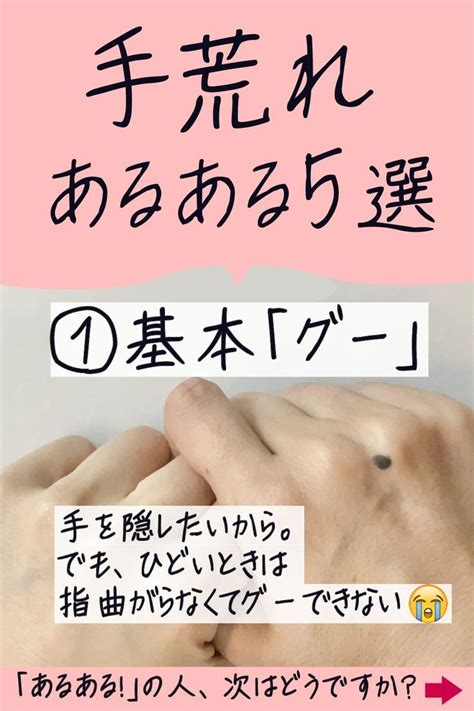 10年悩んで分かった！手荒れがハンドクリームで治らない理由 手荒れ 10年 ハンドクリーム