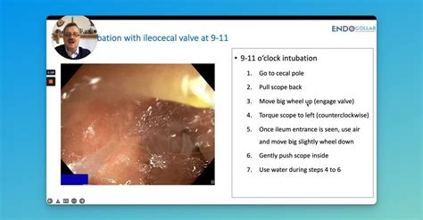 Endocollab™ Gi Endoscopy Education On Linkedin When Intubating The