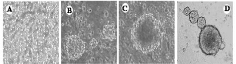 Low Power Photomicrographs Of Rat Embryo Derived Neurospheres In