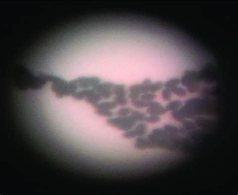 Microscopic Observation Of Leuconostoc Download Scientific Diagram