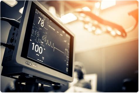 could smart vital sign monitoring provide an early warning system for