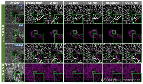 近两年值得阅读的十篇医疗图像分割文献 Multi Organ Segmentation Over Partially Labeled Da Csdn博客