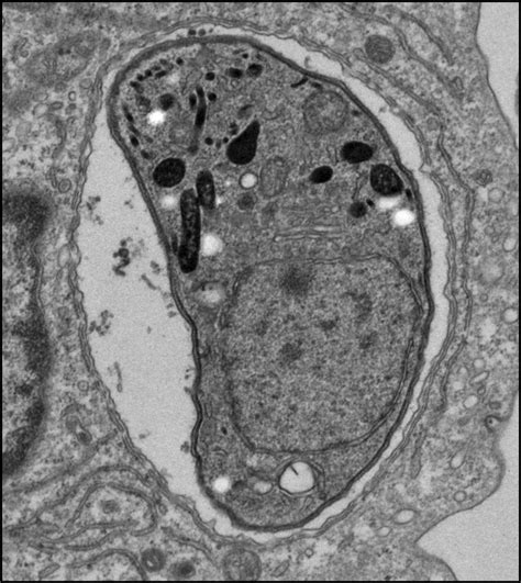 Novel Genetic Screen Provides Clues On How A Parasite Bests The Immune System Asia Research News