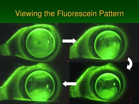 Ppt Fluorescein Patterns Powerpoint Presentation Free Download Id