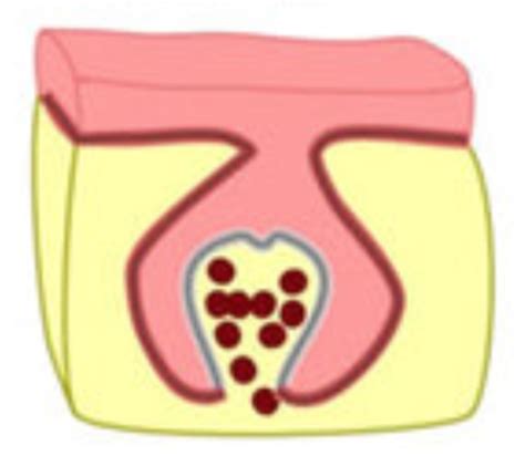 Fetal Age Flashcards Quizlet