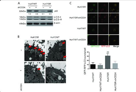 Cd24 Overexpression Regulates Autophagy Activation In Sorafenib