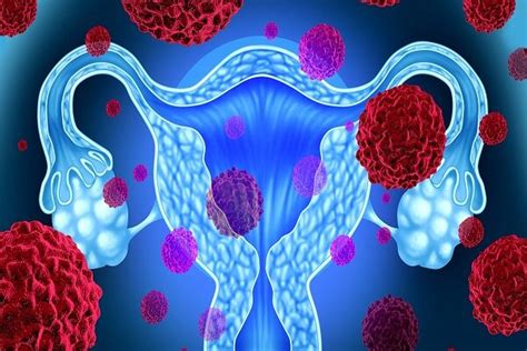 بیماری شایعی که از هر ۱۰ زن یک نفر به آن مبتلا می‌شود ایمنا