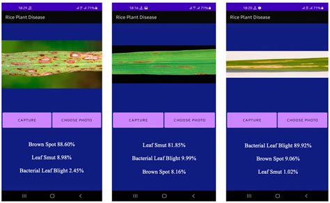 Agriculture Free Full Text Enhancing Rice Crop Management Disease Classification Using