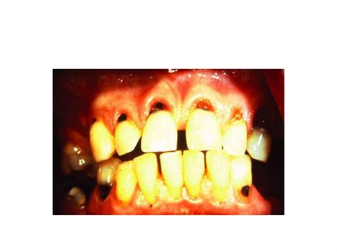 Osce Dental Exams 2 Pptx