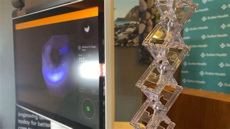Bay Area Doctors Using Ion Robot By Sunnyvale Based Intuitive Surgical