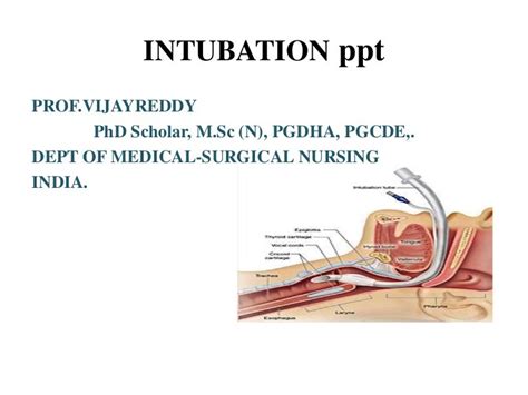 Intubation Ppt