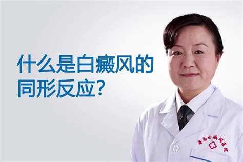 济南白癜风医院宋静医生讲解什么是白癜风的同形反应 凤凰网视频 凤凰网