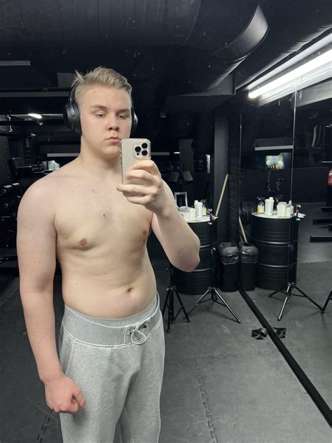 Pre Op Post Op And 7 Week Recovery Pics Rgynecomastia