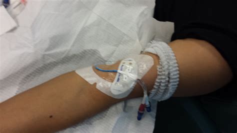 Roberto Fights Cancer PICC Line Pics