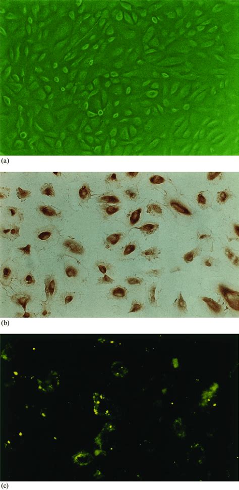 Characterization Of Human Glomerular Endothelial Cells A