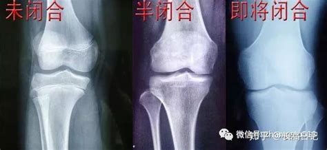 整骨增高促长疗法 冷醫生中醫藥中心 • 自然醫學美容中心 • 中醫診所