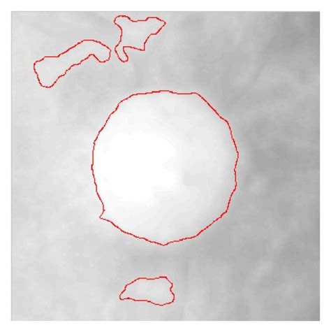 cv and local gaussian distribution model a raw image b cv model