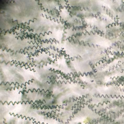 Algae Research Supply Algae Culture Arthrospira Platensis Spirulina