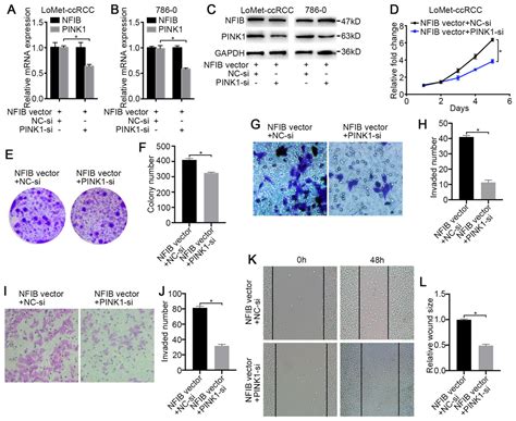 NFIB Promotes The Migration And Progression Of Kidney Renal Clear Cell