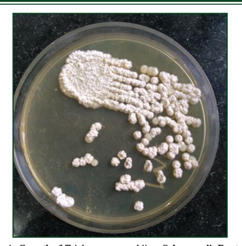 Figure 1 From Trichosporon Asahii Causing Urosepsis A Case Report