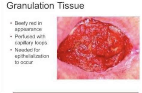 Module 4 Cell Proliferation And Tissue Regeneration And Repair