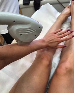Full Body Hair Laser Removal Getting Porn Photo Pics