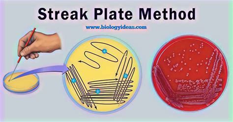 Streak Plate Technique Microbiology Bacterial Diseases Growth Medium