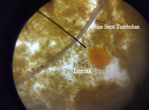 Rizqi Murtafi Ah Pemeriksaan Feses Lengkap