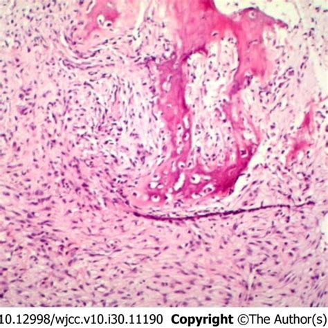 Histopathological Examination The Nuclei Are Hyperchromatic Download Scientific Diagram